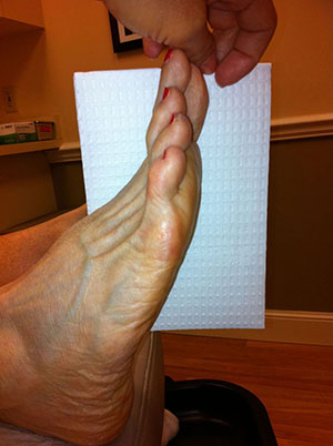 Fat Pad Restoration - Boca Raton | Boynton - Boca Raton Foot Care