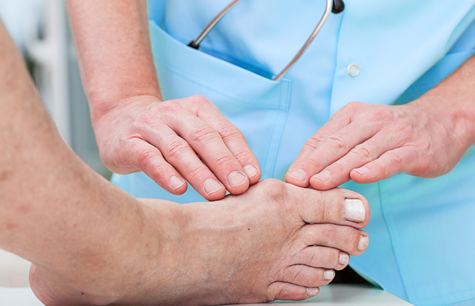 Bunion Surgery in Boca Raton, FL | Expert Bunion Surgery and Bunion ...