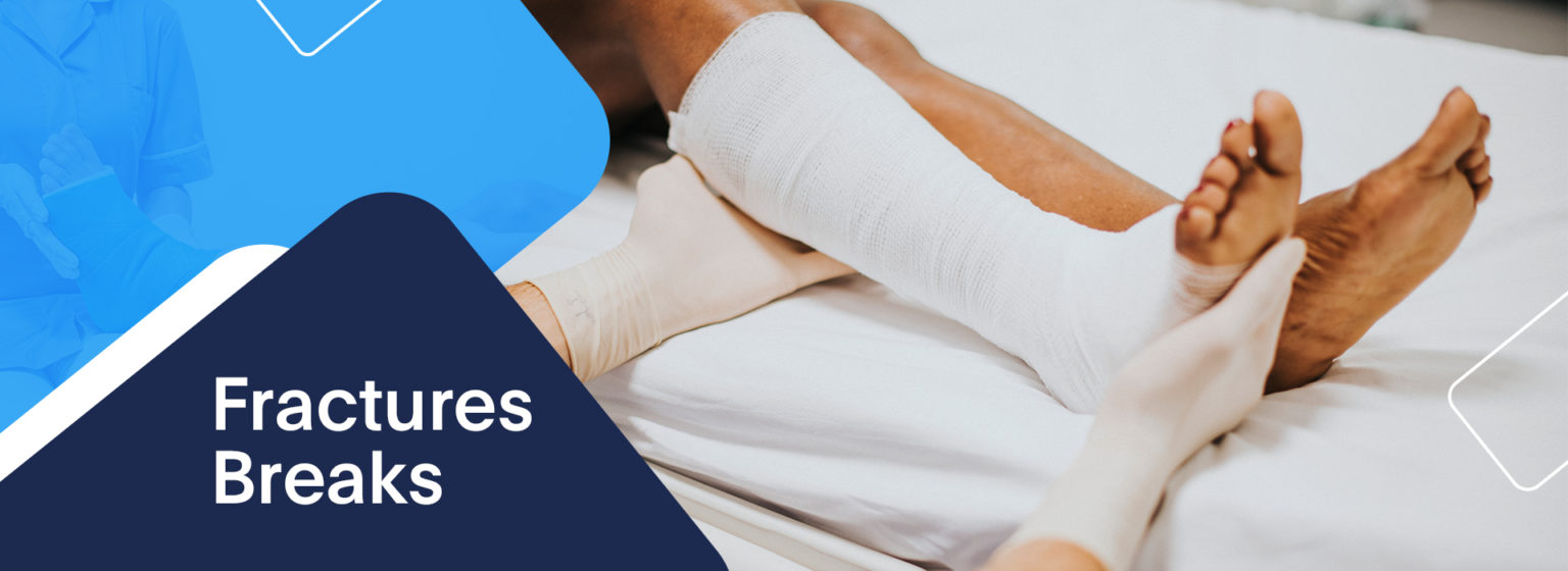Fractures Breaks - Boca Raton | Boynton Beach Foot Doctors