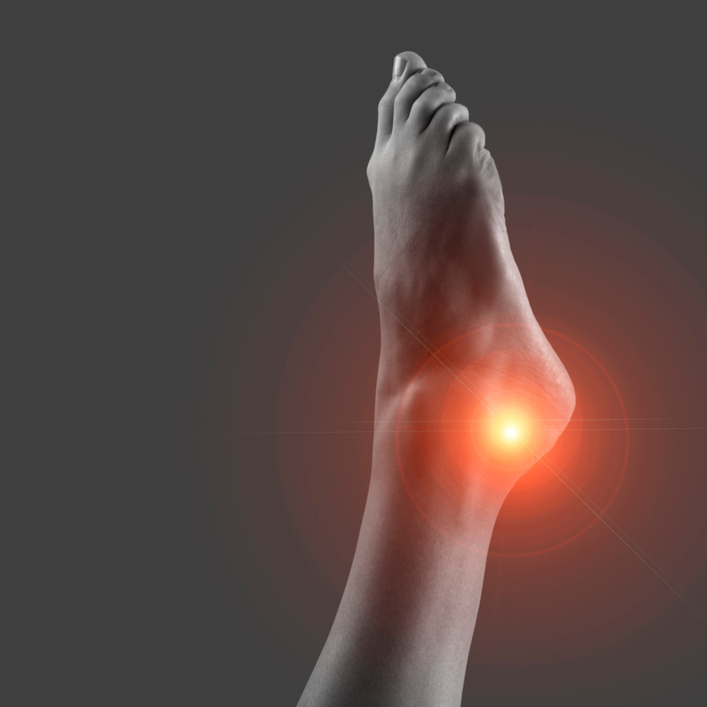 Nighttime Foot Pain? Learn About Tarsal Tunnel Syndrome