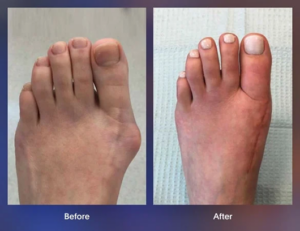 Podiatrist in Boca Raton & Boynton Beach - Foot Care Center