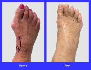 Podiatrist in Boca Raton and Boynton Beach, FL | Foot and Ankle Specialists