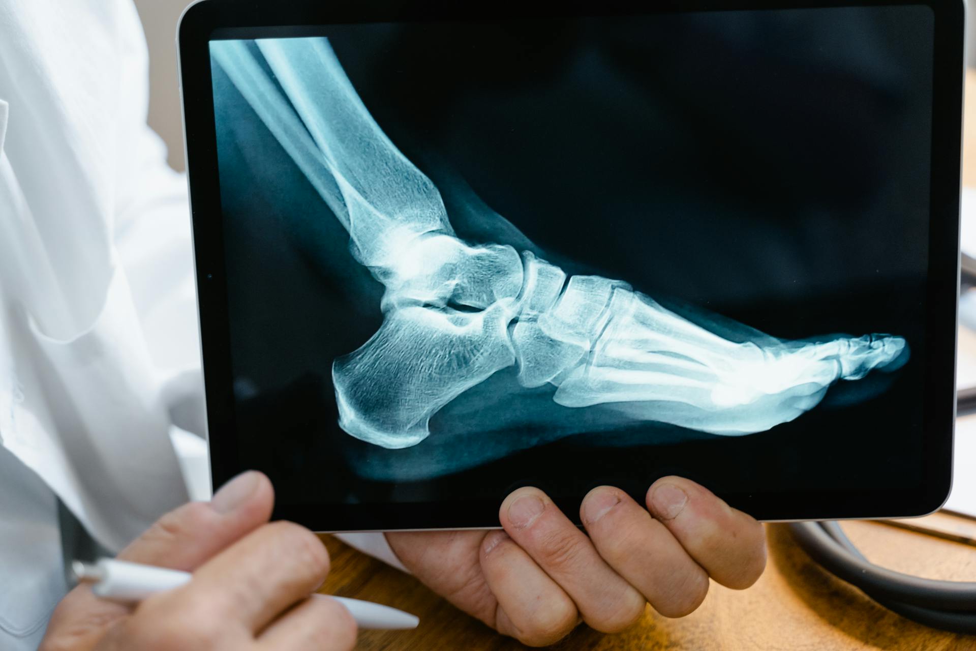 Foot Trauma Treatment in Boca Raton and Boynton Beach, FL